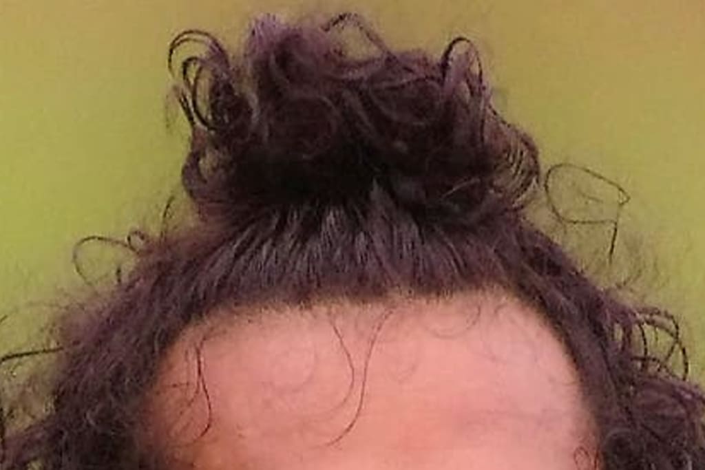 QUIZ: Name That Hair! - Zero Tackle